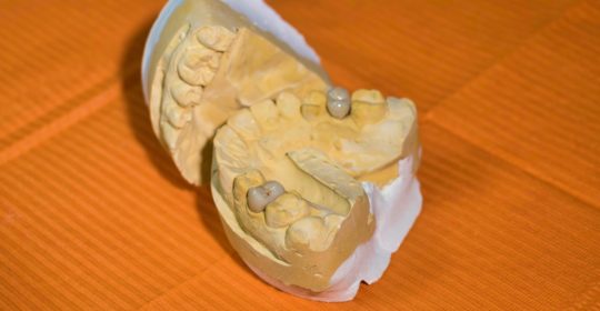 What Are Our Teeth Made From?